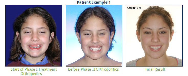 Phase Two Orthodontics